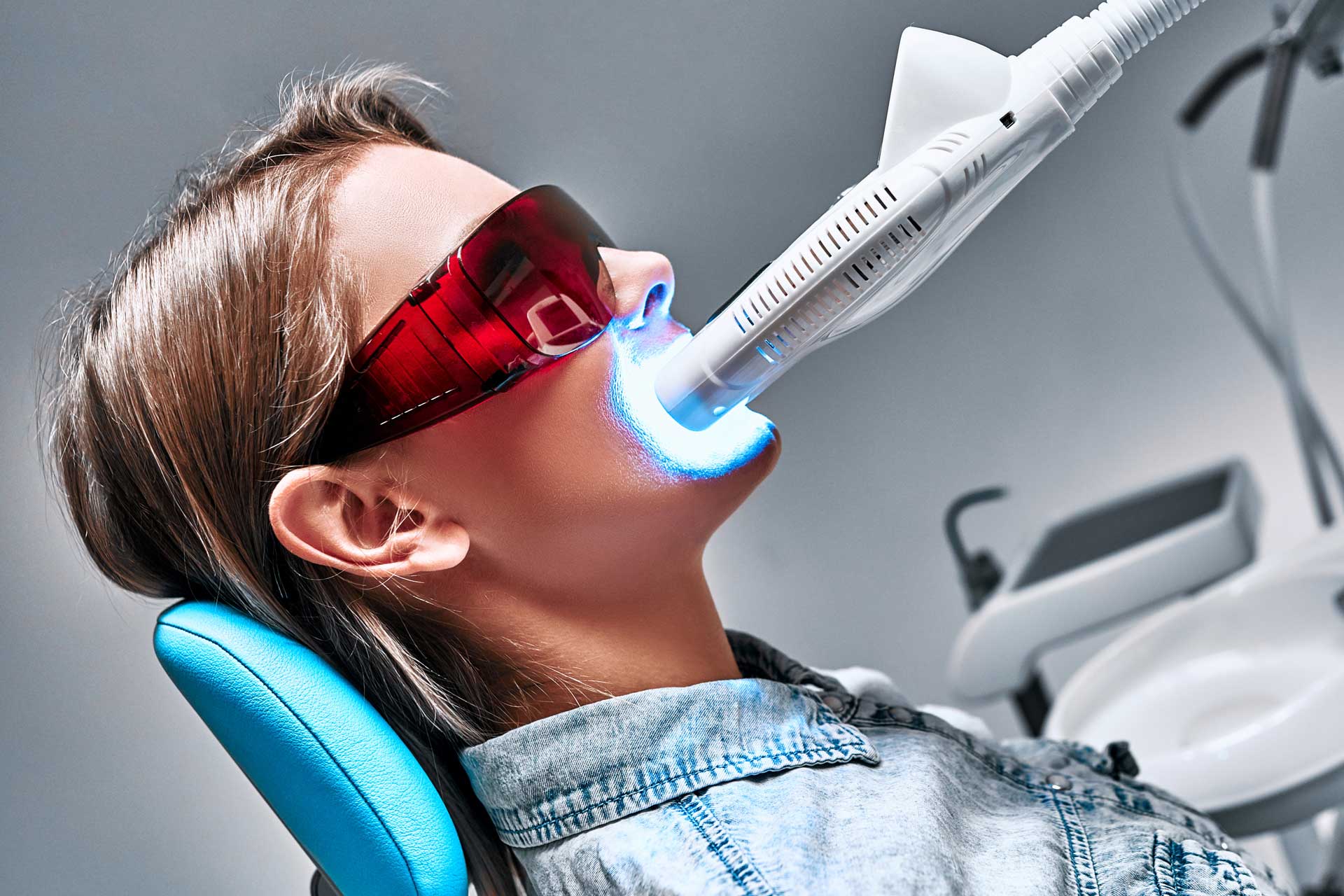 Bleaching – Dr. Reichle & Kollegen